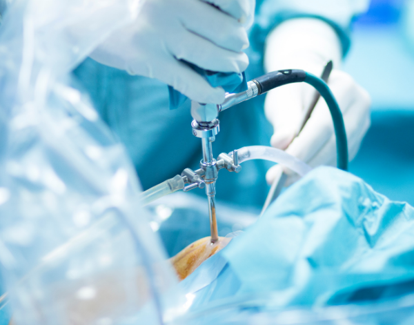 Sales at CONMED | CONMED Careers