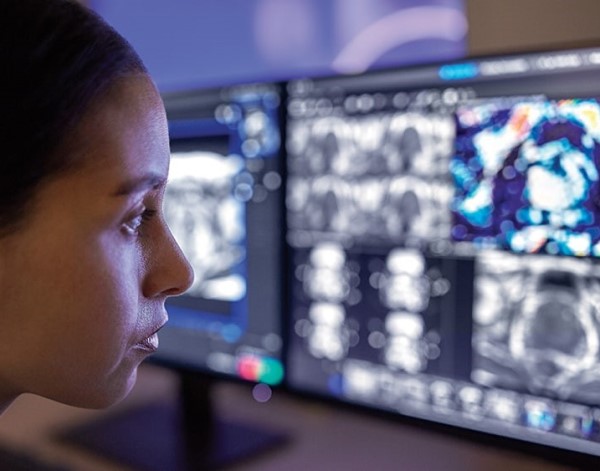 Philips Tech Careers | Philips